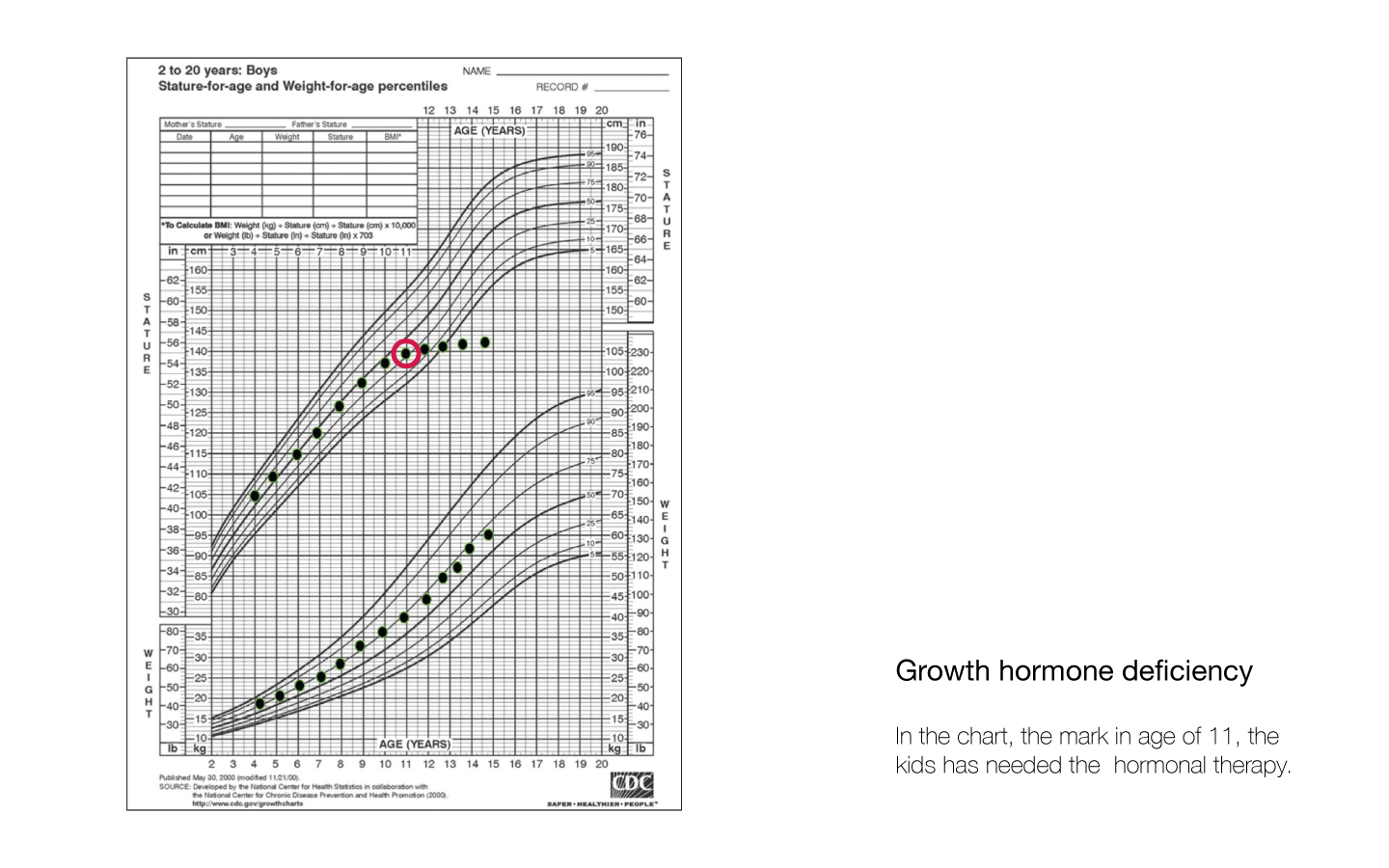 Growth Hormone Deficiency Chart